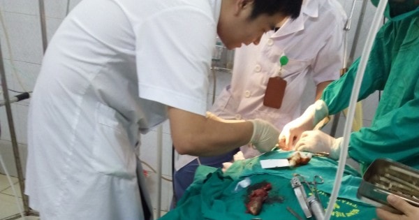 Thanh Hóa: Một người dân bị cá rô chui vào phế quản