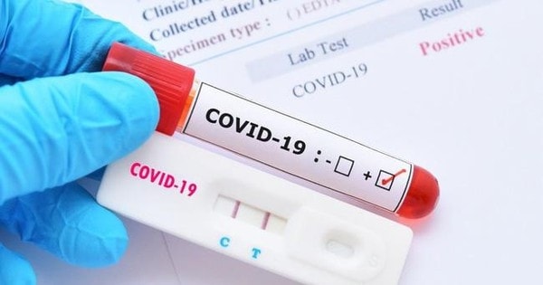 Bộ Công Thương khuyến cáo không nên mua kit test nhanh kháng nguyên ...